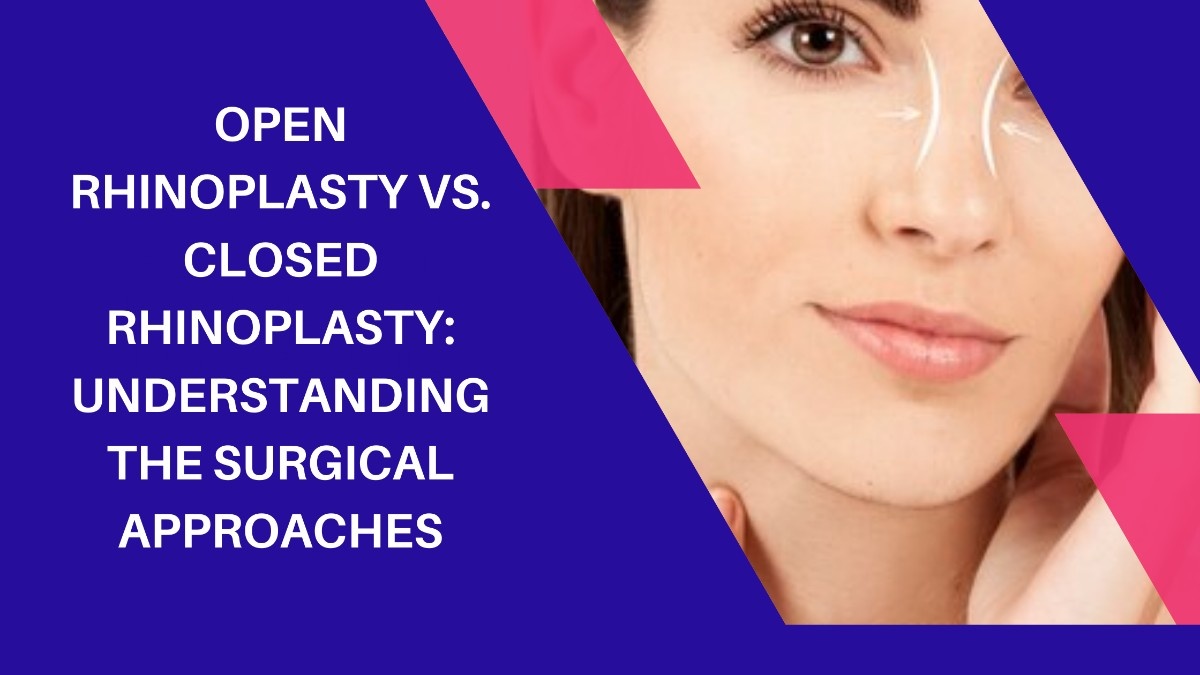 Open Rhinoplasty vs. Closed Rhinoplasty: Understanding the Surgical ...