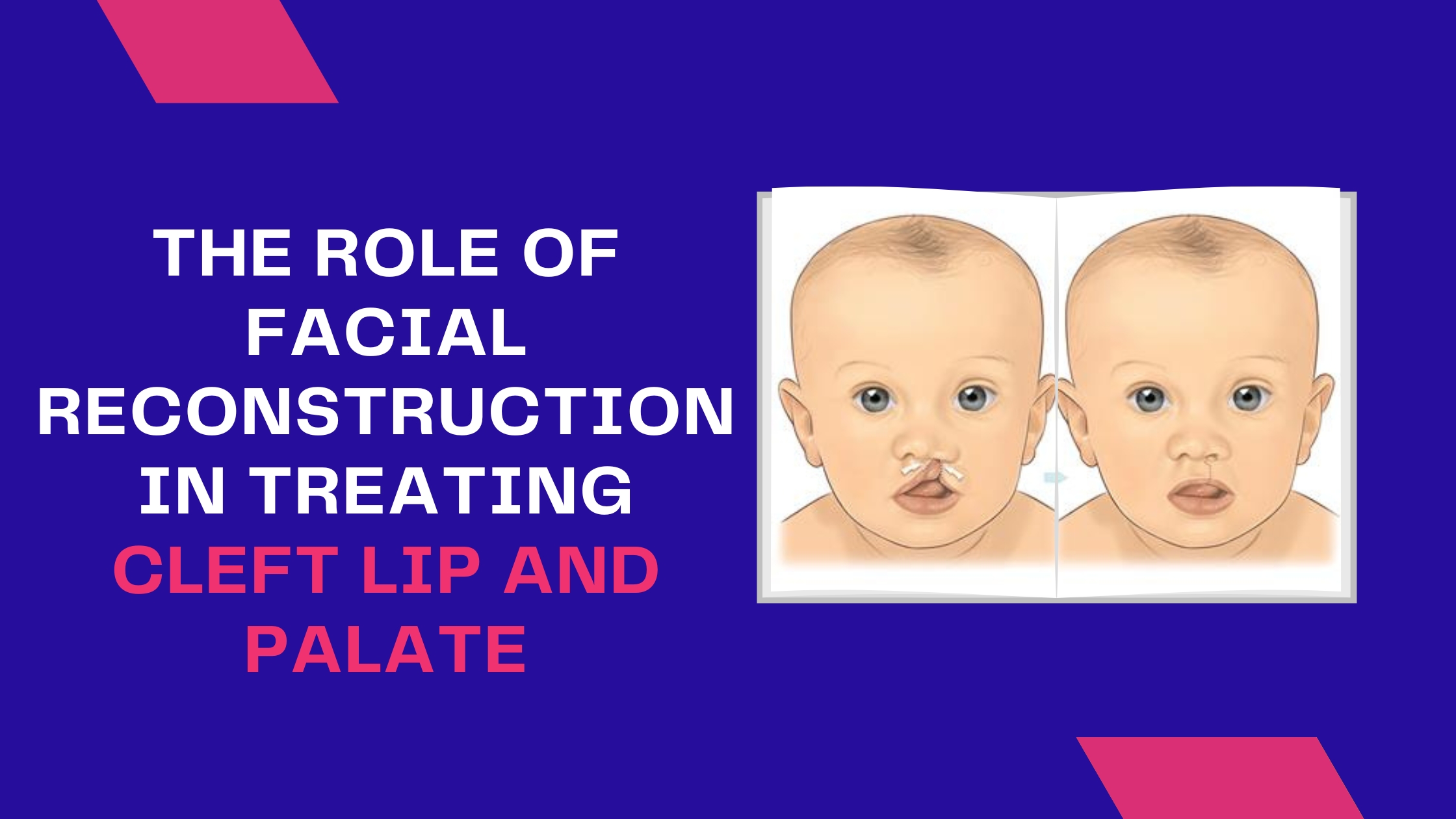 Cosmetic Surgeon in Pune | Plastic Surgeon in Pune | Dr. Amit Mulay